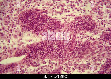 A section trough lymph node cells under the microscope Stock Photo - Alamy