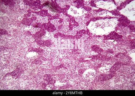 A section trough lymph node cells under the microscope Stock Photo - Alamy