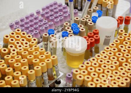 Complete Blood Count CBC or Hemogram, Hemotherapy, Donostia Hospital ...