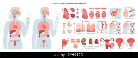 medical illustration of the effects of cigarette smoking on the lungs ...