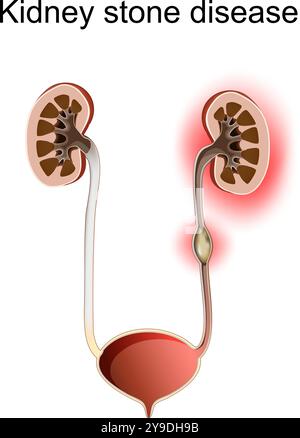 Urinary system anatomy. Close-up of human Kidneys with Urinary bladder ...