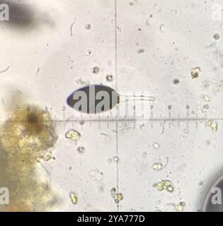 (Podospora anserina) Fungi Stock Photo - Alamy