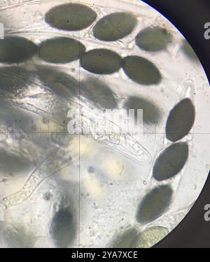 (Podospora anserina) Fungi Stock Photo - Alamy
