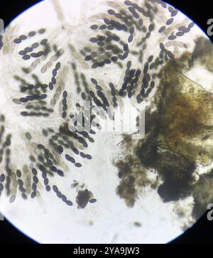 (Podospora anserina) Fungi Stock Photo - Alamy