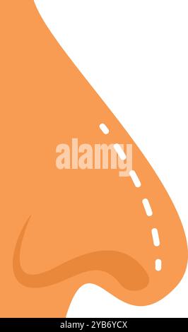Nose surgery showing rhinoplasty procedure with dotted line marking ...