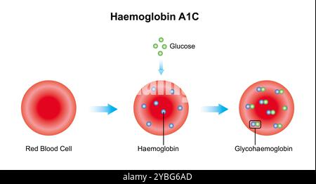 Glycated haemoglobin, illustration Stock Photo - Alamy