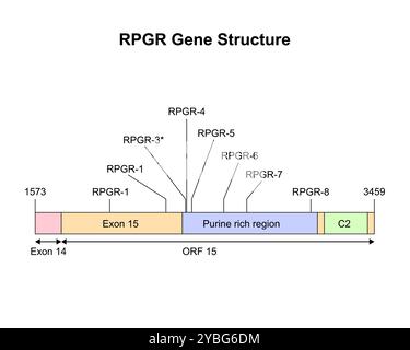 Retinitis pigmentosa, illustration Stock Photo - Alamy