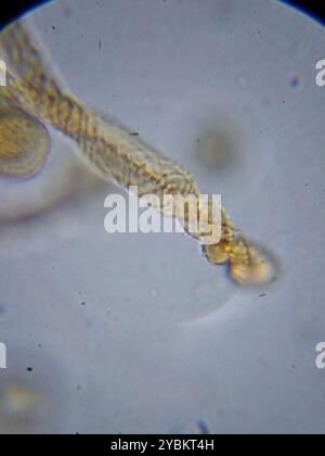 (Trichia erecta) Protozoa Stock Photo - Alamy