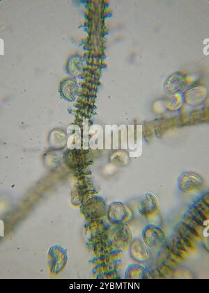 (Arcyria affinis) Protozoa Stock Photo - Alamy