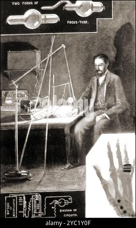 First medical X-ray by Wilhelm Röntgen of his wife Anna Bertha Ludwig's ...