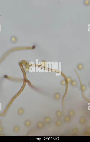 (Trichia botrytis) Protozoa Stock Photo - Alamy