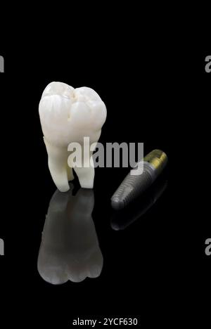 Human tooth and titanium implant Stock Photo - Alamy