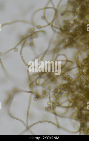 (Trichia varia) Protozoa Stock Photo - Alamy
