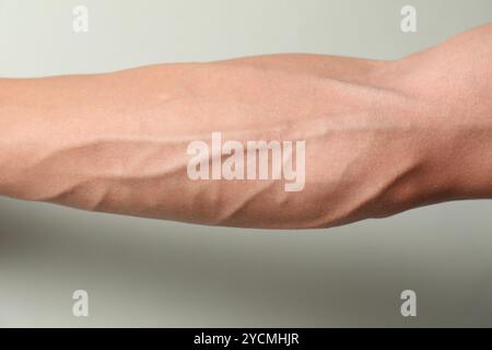 Man with bulging veins on his arm against light background, closeup ...