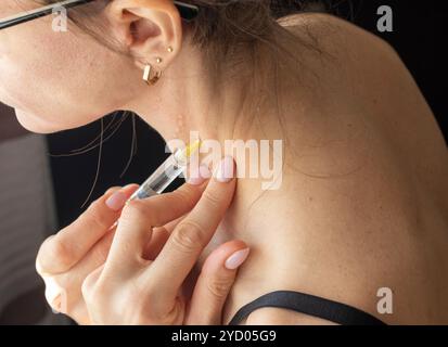 Woman performing mesotherapy, bio revitalization procedure, injecting ...