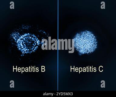 Side-by-side transmission electron micrograph images of hepatitis B and ...