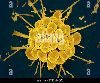 Scanning electron micrograph of Neisseria gonorrhoeae bacteria, which ...