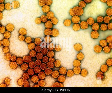 Colorized electron micrograph of HPV virus particles pink harvested and ...