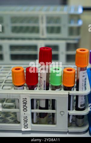 Medical analysis laboratory. Blood samples classified before analysis ...