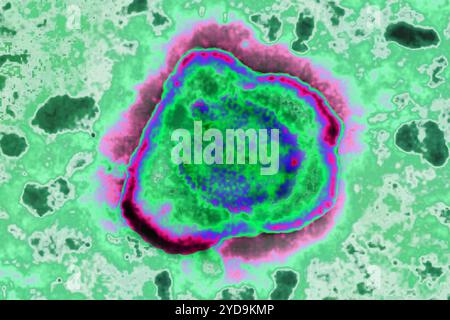 Herpes virus (HSV. HSV is the cause of cold sores, genital herpes ...