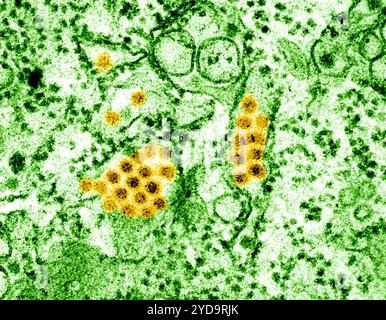 Transmission electron micrograph of dengue virus particles (green ...