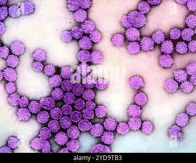Colorized electron micrograph of HPV virus particles pink harvested and ...