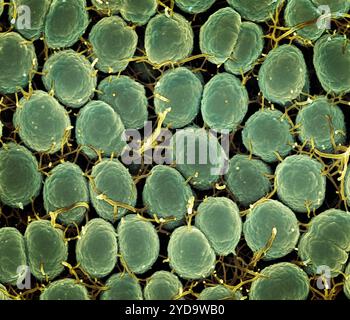 Scanning electron micrograph of Neisseria gonorrhoeae bacteria, which ...