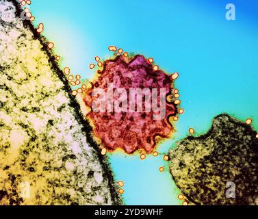 transmission electron microscope image of yellow fever virus Stock ...