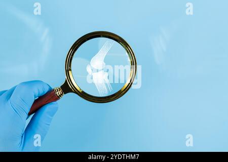 Hand with magnifying glass over patella of human skeleton with red spot ...