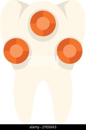 Illustration of image of cavity progression, simple line drawing ...