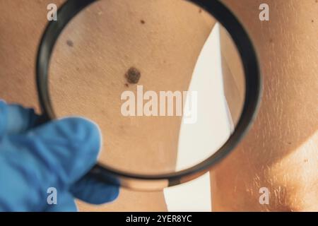 Dermatologist with magnifier examining patient in clinic, closeup Stock ...