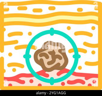 targeted therapy cancer treatment color icon vector illustration Stock ...