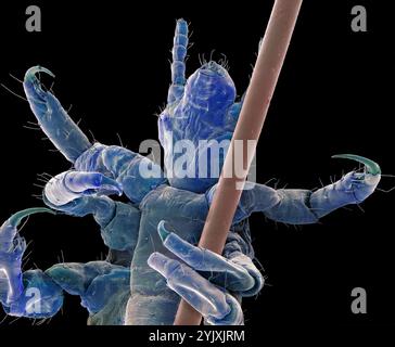 Scanning electron micrograph SEM of the head, called the scolex, of a ...