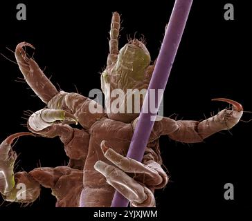 Head louse. Coloured scanning electron micrograph (SEM) of a head louse ...