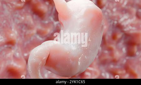 Stomach Acid Relux. Esophagus, gerd. Pain In The Digestive System ...