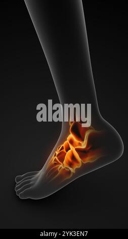 Chronic Ankle Joint Pain and Inflammation Syndrome Stock Photo - Alamy