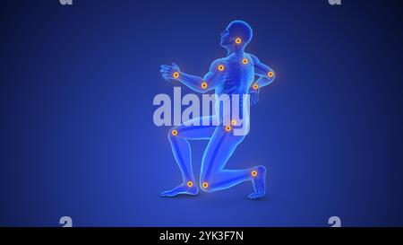Chronic Pain in Multiple Body Joints Stock Photo - Alamy