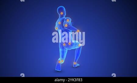 Chronic Pain in Multiple Body Joints Stock Photo - Alamy