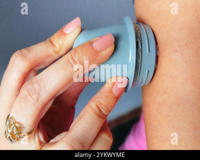 Device for continuous glucose monitoring – CGM and white sensor. Daily ...