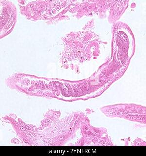 Capillaria philippinensis HE1 Stock Photo - Alamy