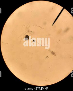 Lobose amoebae (Lobosa Stock Photo - Alamy