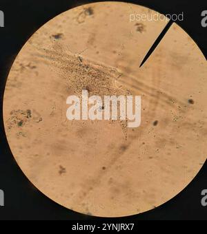 Lobose amoebae (Lobosa Stock Photo - Alamy