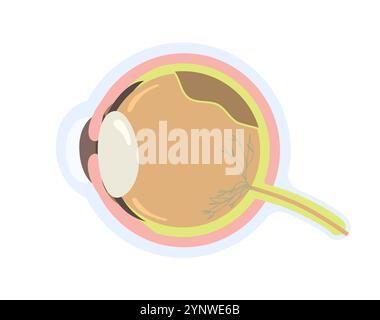 Retinal detachment, illustration Stock Photo - Alamy