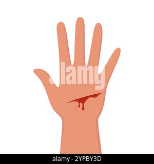 Bleeding cut on the palm, emergency situation. First aid treatment for ...