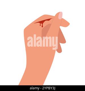 Bleeding cut on the palm, emergency situation. First aid treatment for ...