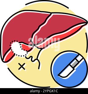 cholecystectomy surgery color icon vector illustration Stock Vector ...