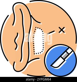 otoplasty surgery color icon vector illustration Stock Vector Image ...