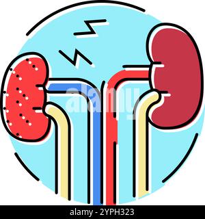 nephrectomy urology color icon vector illustration Stock Vector Image ...