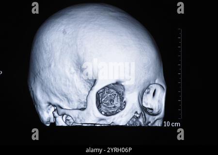 Human skull CT scans Stock Photo - Alamy