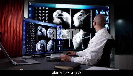 Doctor Screening Shoulder X Ray On Computer Stock Photo - Alamy